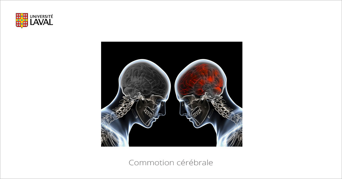 Commotion cérébrale | MOOC Francophone